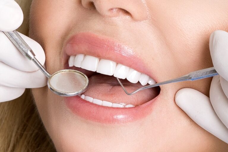 Start Your Smile Makeover Now | Miami Perfect Smile