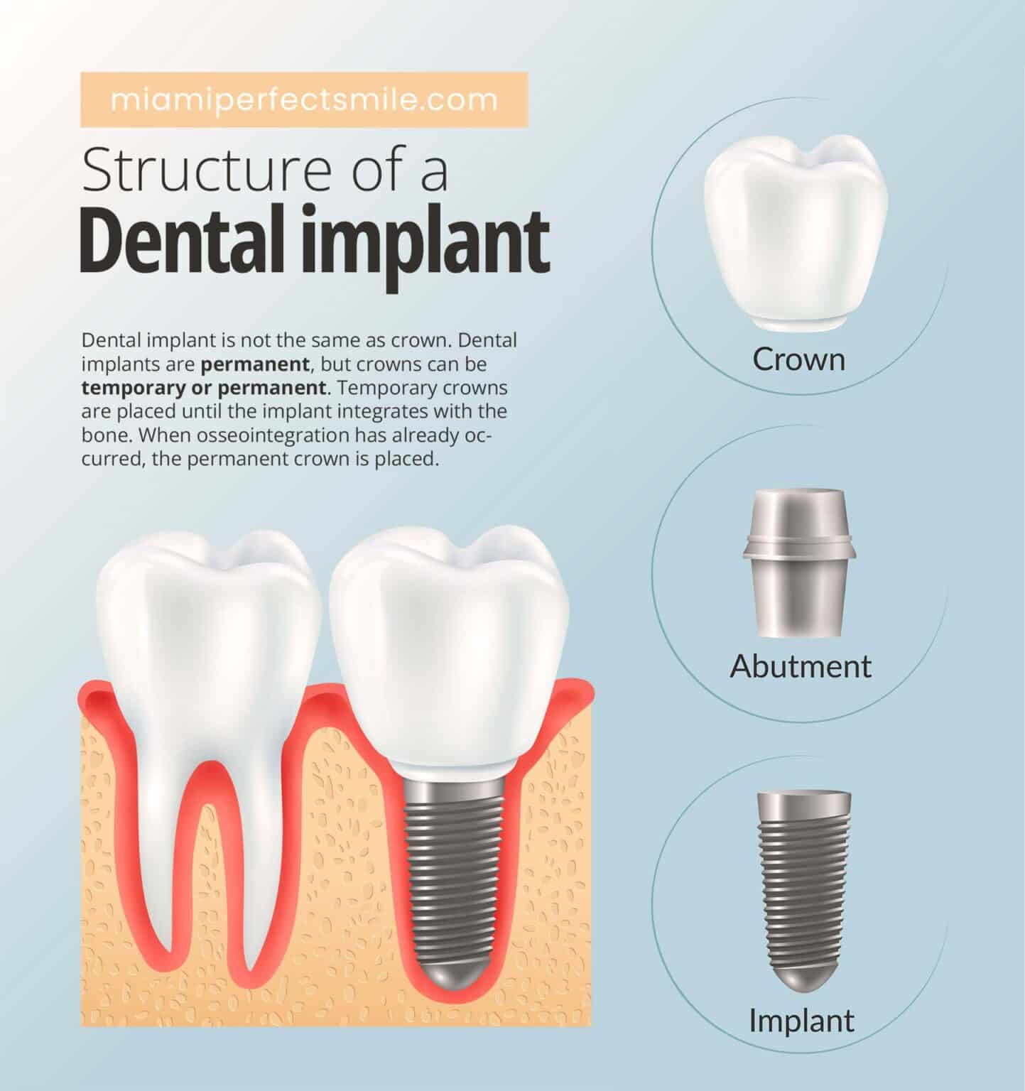 Difference between temporary and permanent dental implants