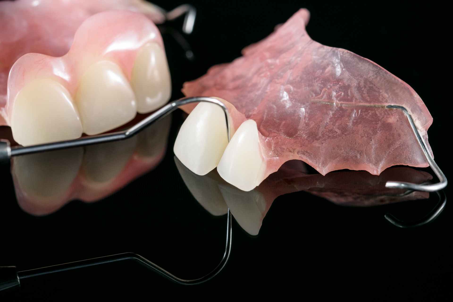 Difference between temporary and permanent dental implants
